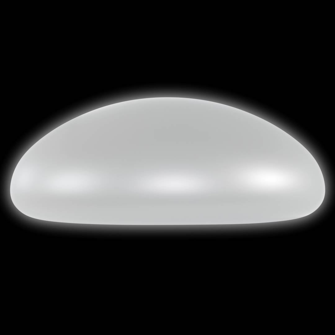 300 cc Breast Implant - Before and After | Estherian Clinic