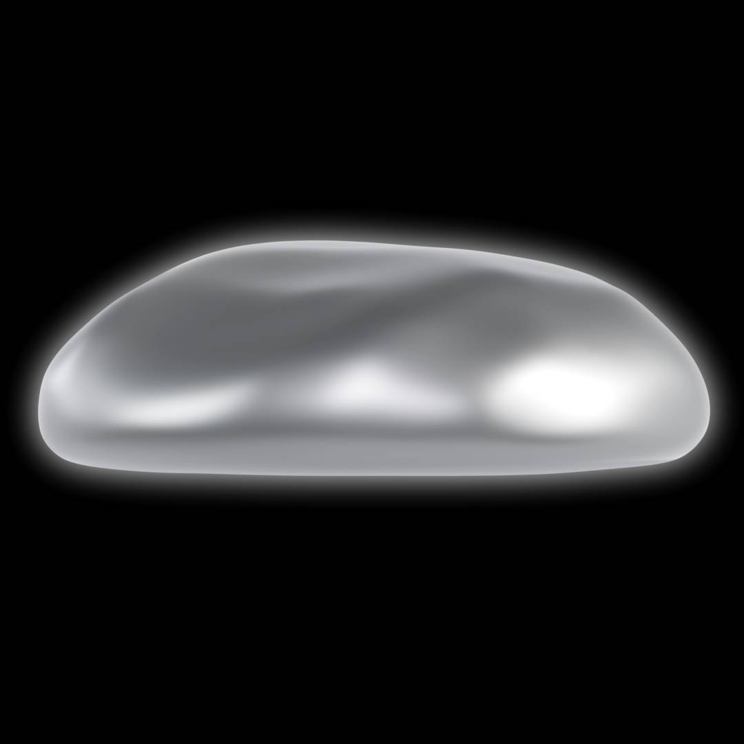 300 cc Breast Implant - Before and After | Estherian Clinic