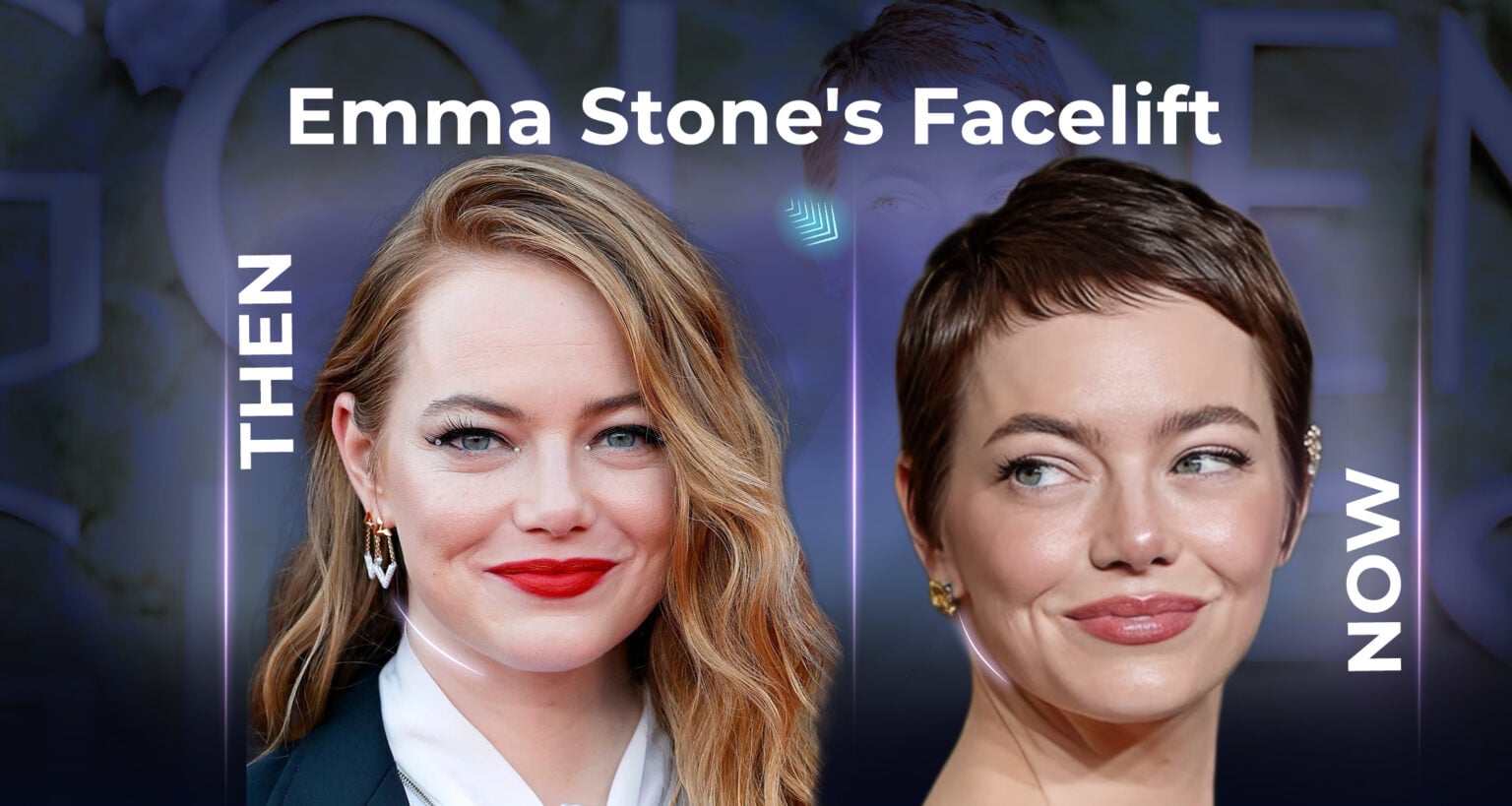 Emma Stone’s Newest Transformation: Is It a Facelift? | Estherian Clinic