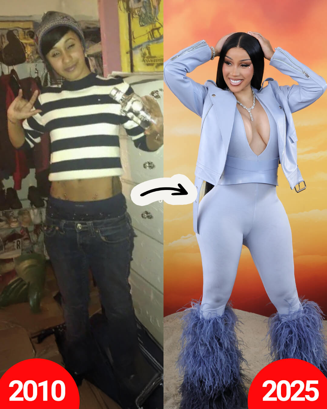 The BBL Boom: How Celebrities Sparked the Trend and Why Global Patients ...