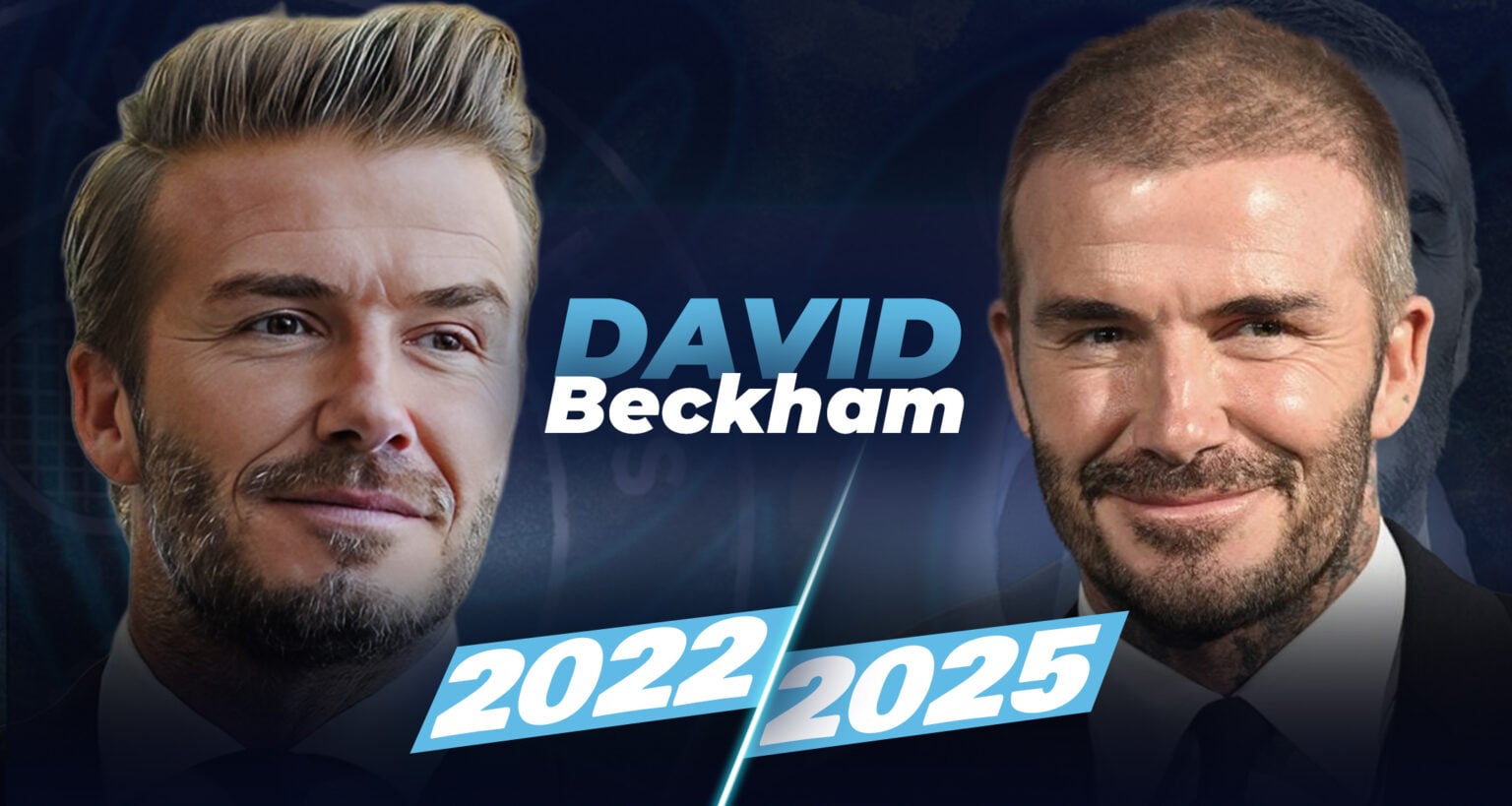 David Beckham – A-t-il eu recours à la chirurgie esthétique ...