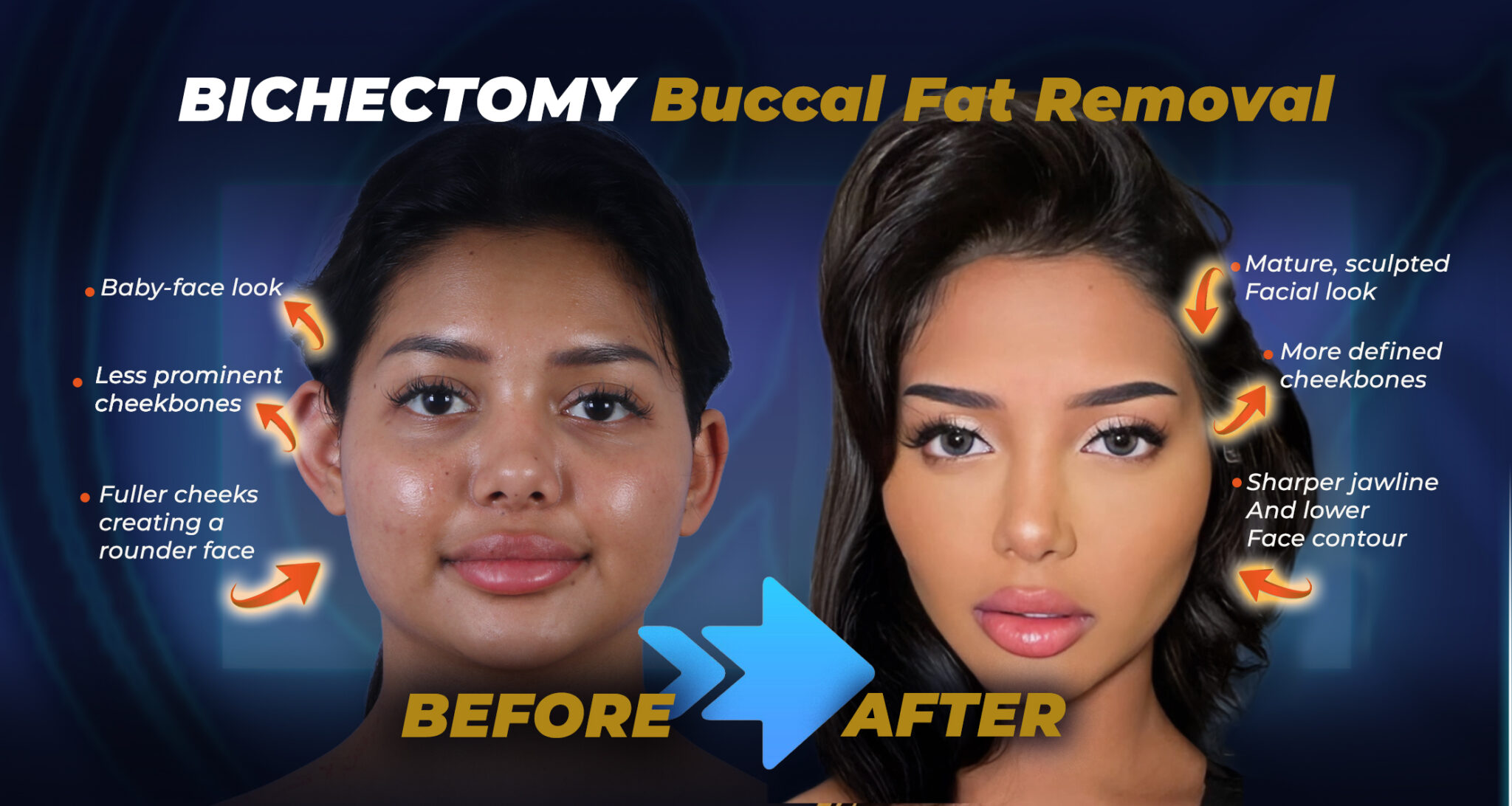 Chiseled Cheeks 101: Is Buccal Fat Removal the Answer? | Estherian Clinic