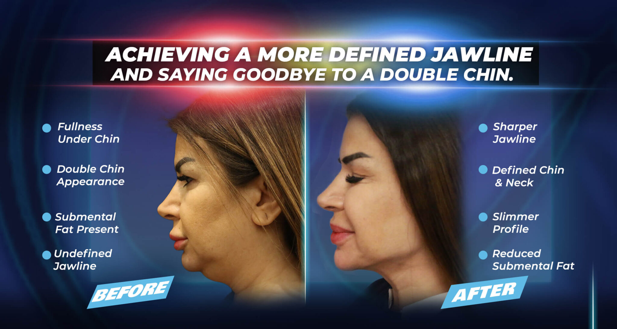 Your Complete Chin Lipo Recovery Timeline | Estherian Clinic