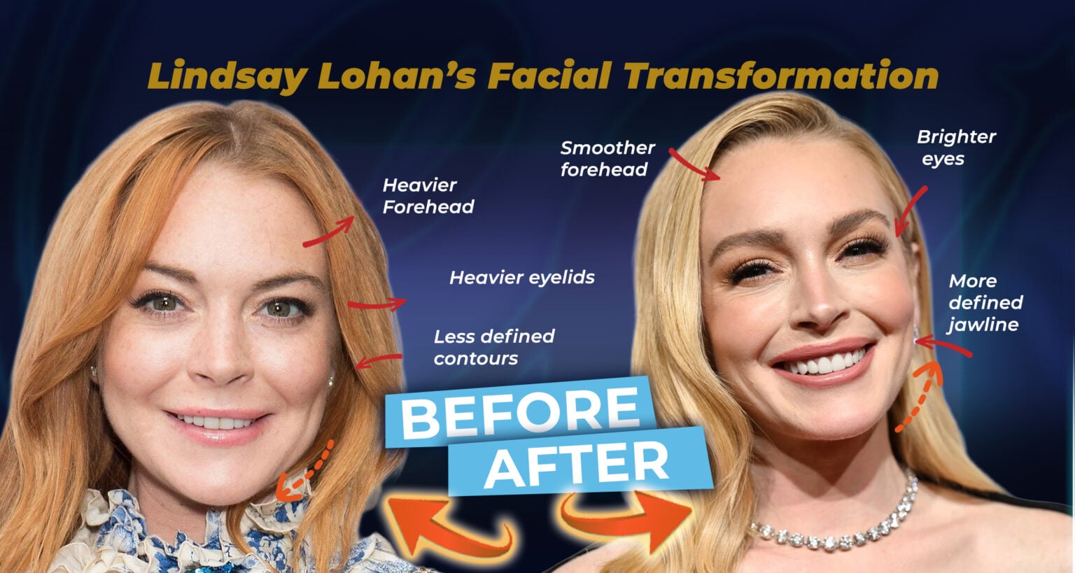 Lindsay Lohans Schönheitsoperationen: Ein Blick auf ihre Transformation ...
