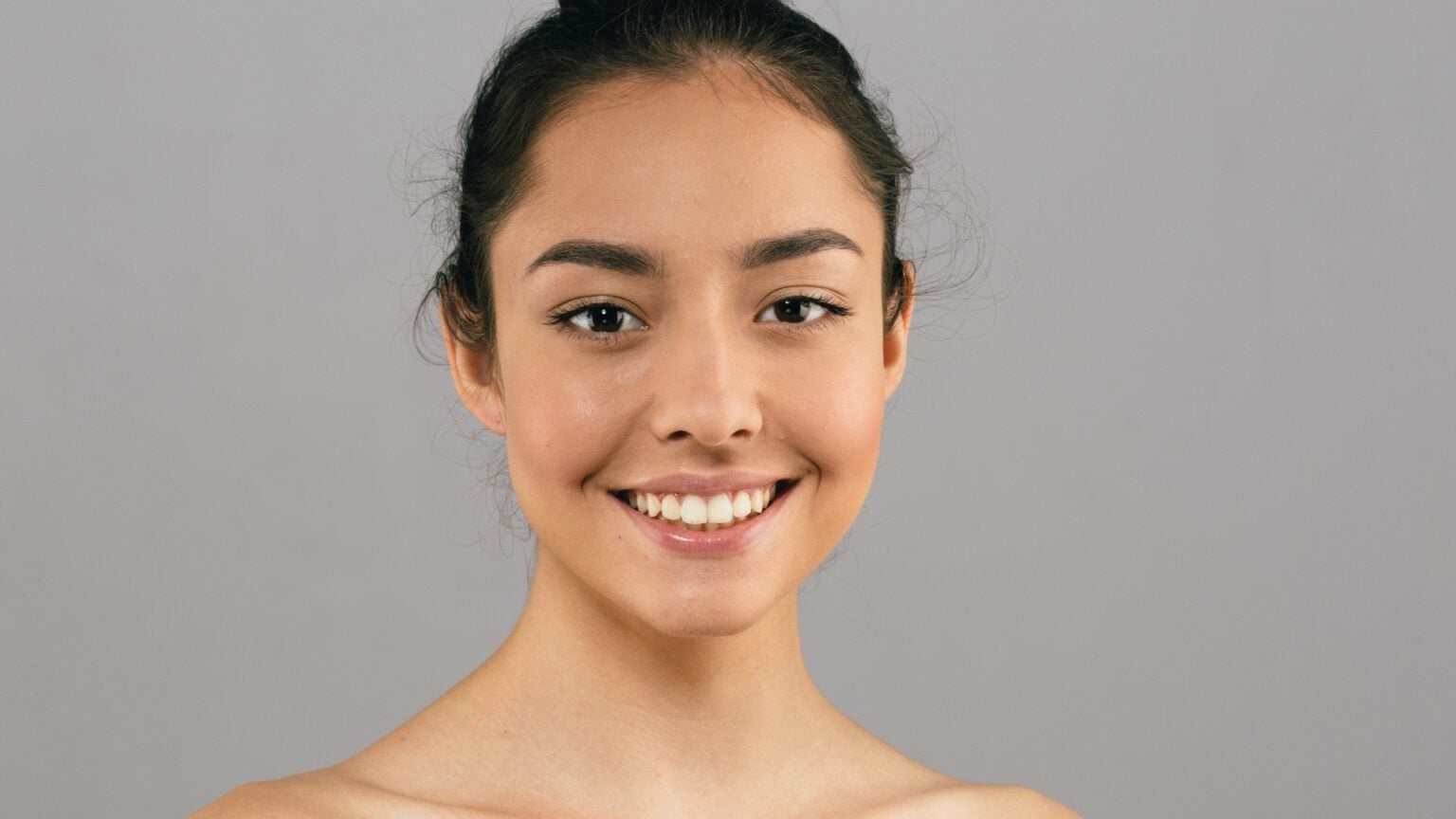 300 cc Breast Implant - Before and After | Estherian Clinic