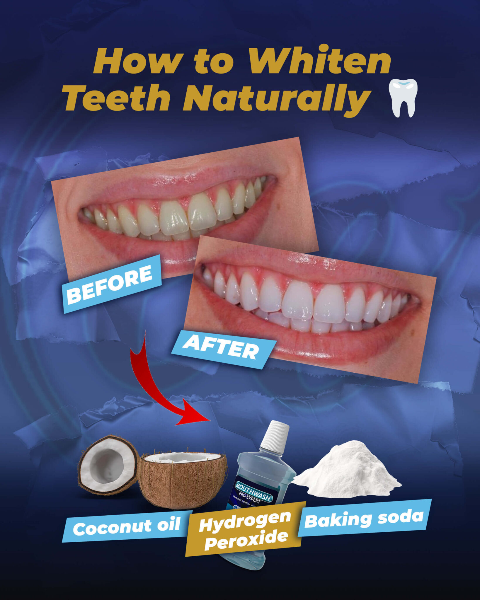 How to Whiten Teeth Naturally | Estherian Clinic
