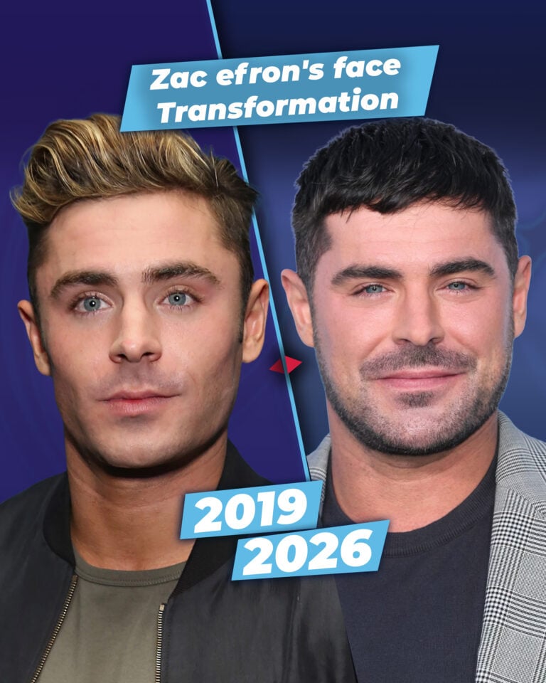 Zac Efron Plastic Surgery | Estherian Clinic