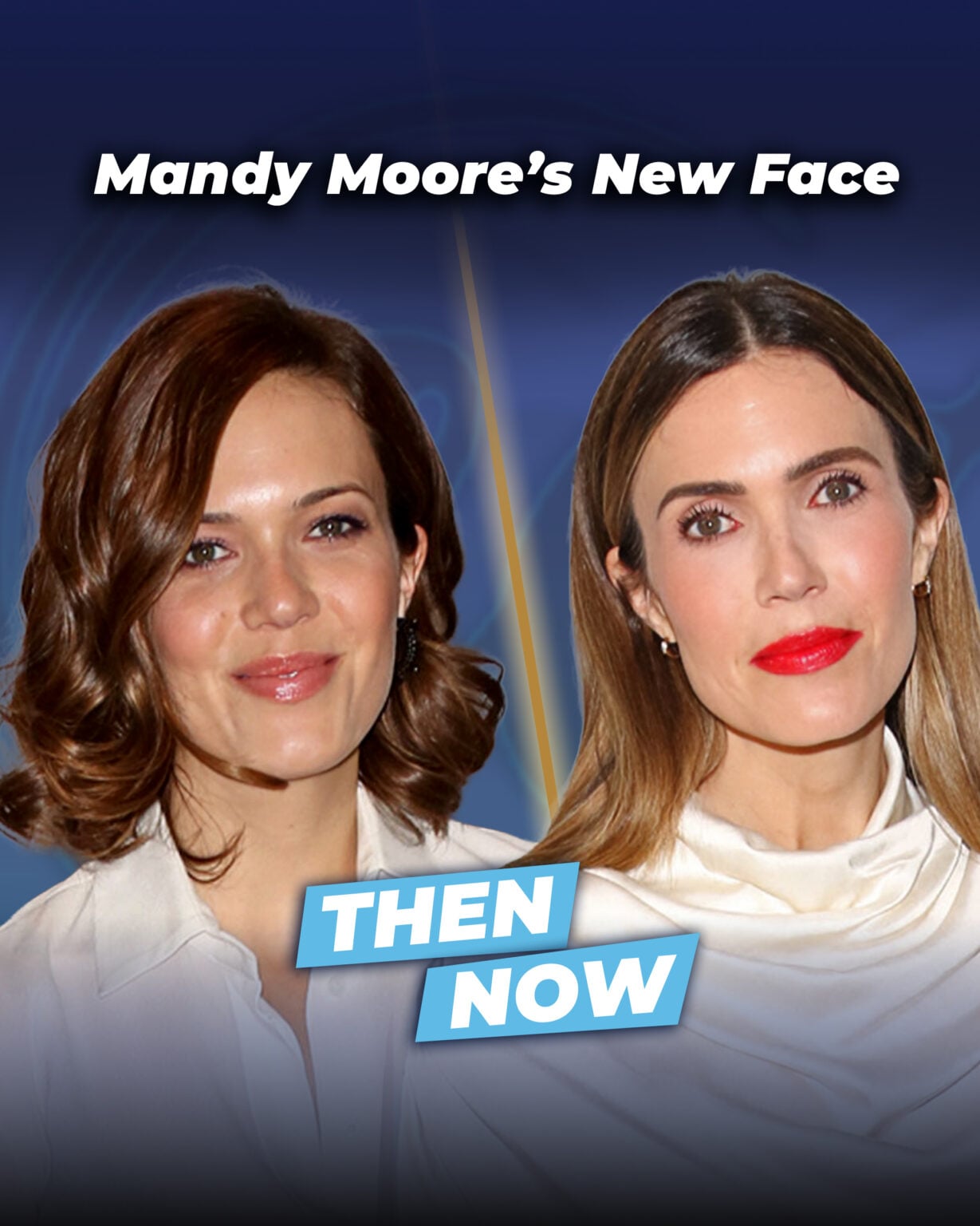 Mandy Moore’s New Face: The Procedures Behind the Transformation ...
