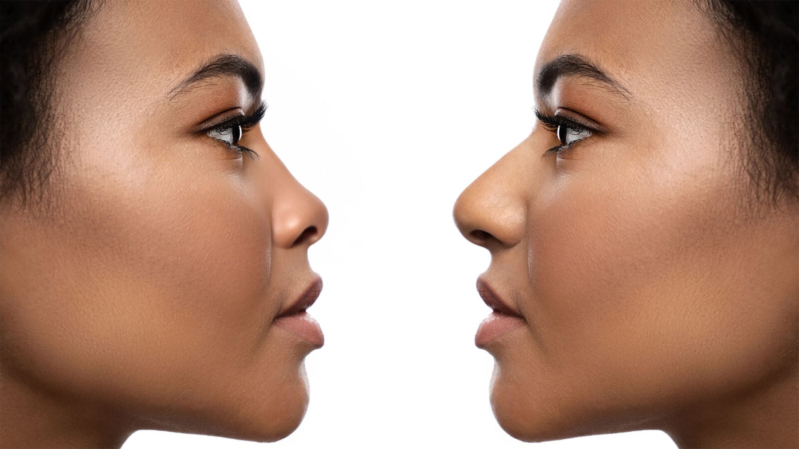 Die verschiedenen Nasenformen verstehen