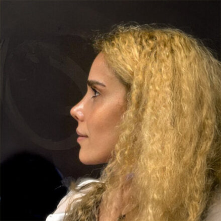 Understanding Different Nose Shapes: A Comprehensive Guide | Estherian ...
